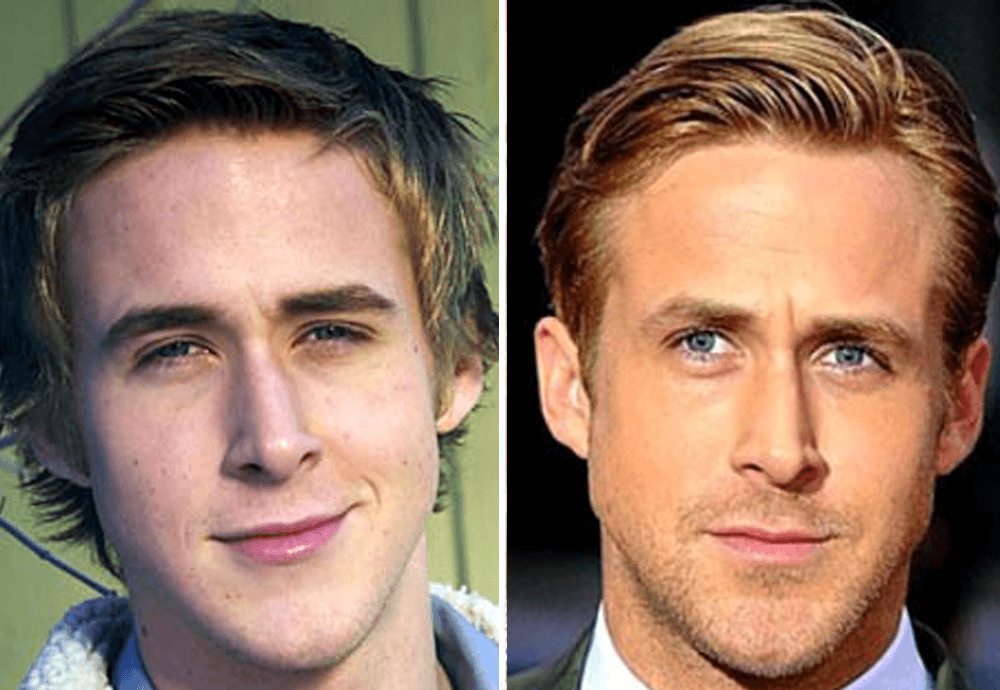 Antes Despues Ryan Gosling Antes Despues Ryan Gosling